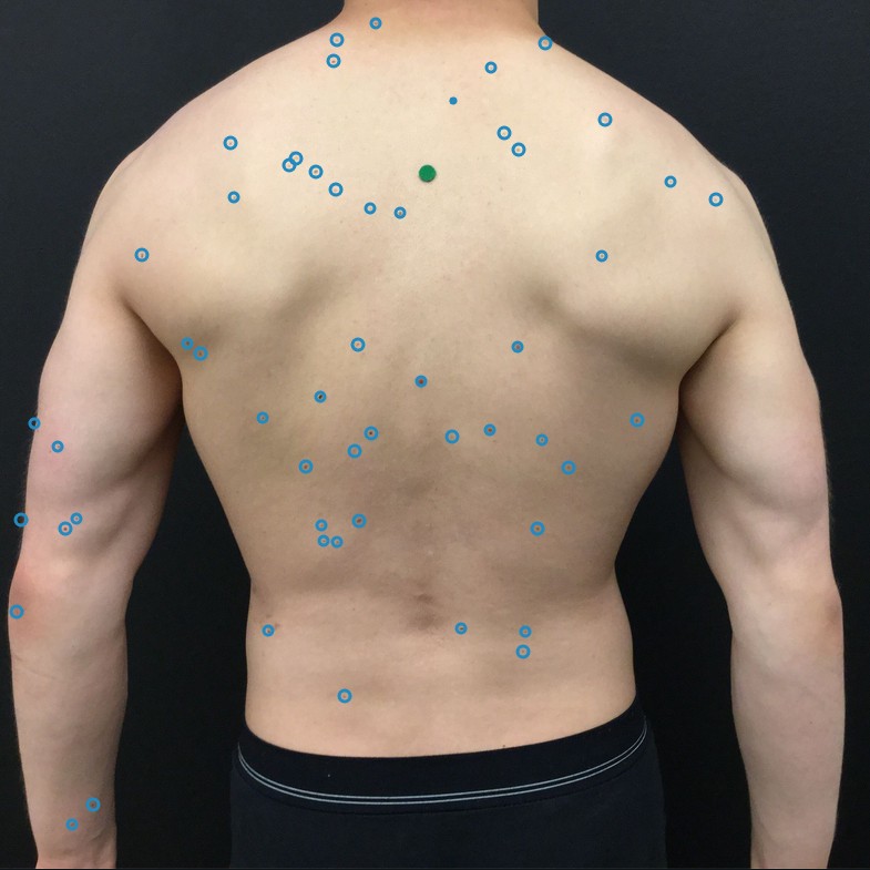 Using AI to Help Doctors Track Skin | SkinIO